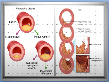 Clase 30 Ceb 2025 Sanatorio Modelo De Caseros